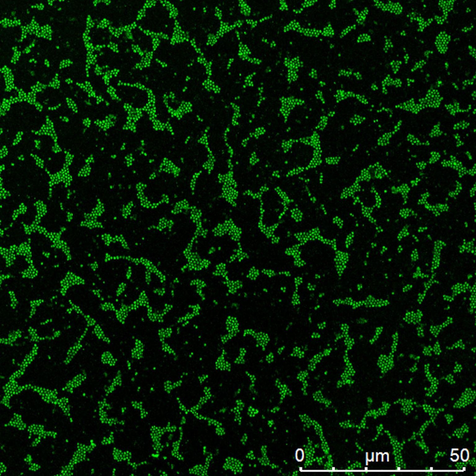 NASA Science: ODYSSEY—Analyzing Bacteria in Space, Simulated Microgravity