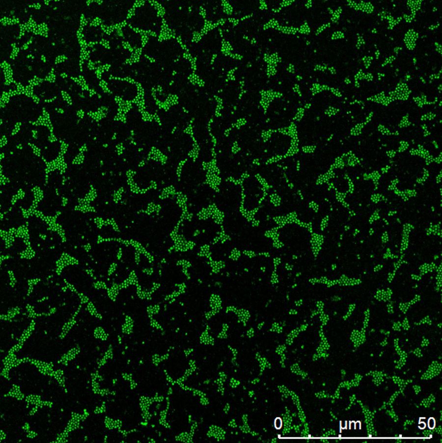 NASA Science: ODYSSEY—Analyzing Bacteria in Space, Simulated Microgravity
