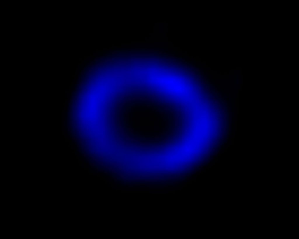 Hubble Captures Wide View of Supernova 1987A - NASA Science